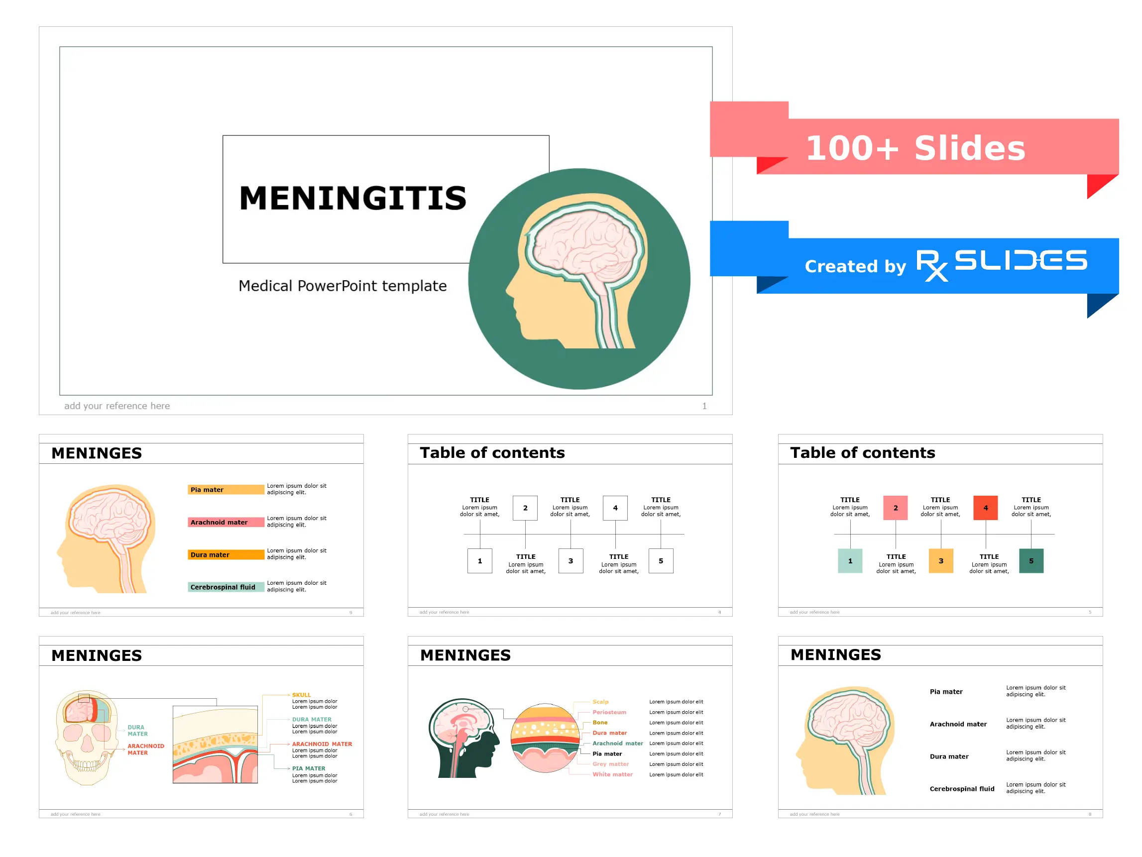 Download Meningitis PowerPoint Template| RxSlides